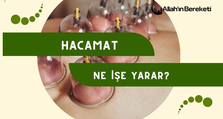Hacamat Ne İşe Yarar? Neye İyi Gelir? | Allah'ın Bereketi | Allah'ın ...