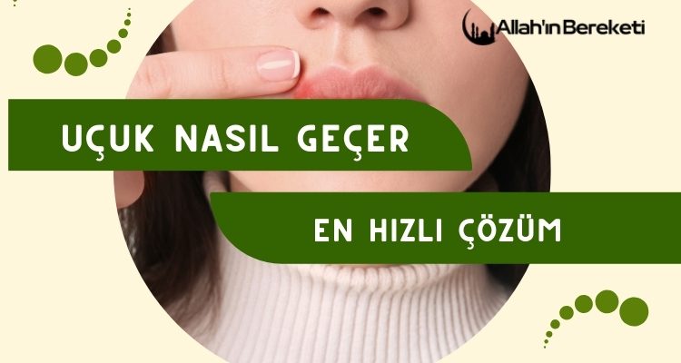 Uçuk Nasıl Geçer? En Hızlı Çözüm | Allah'ın Bereketi | Allah'ın İsimleri